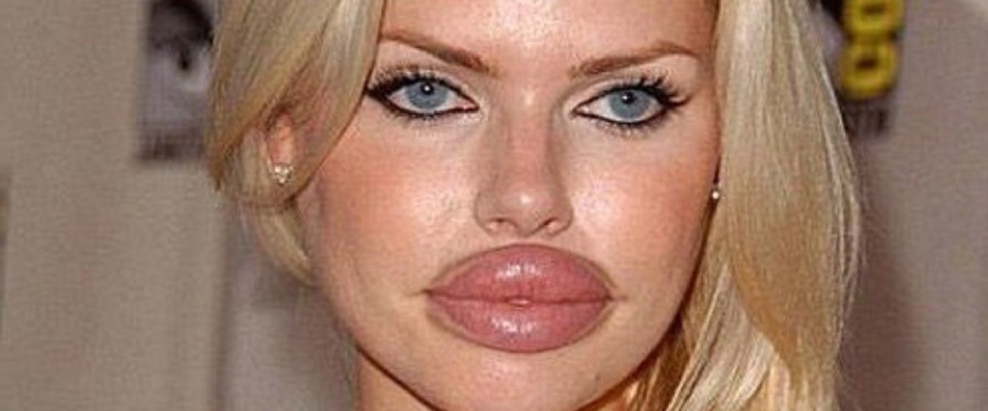 The Fascinating History of Facial Fillers